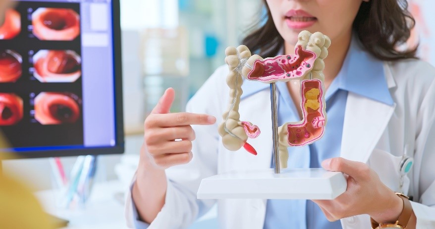 The Importance of a Colonoscopy: A Lifesaving Screening for Colorectal ...